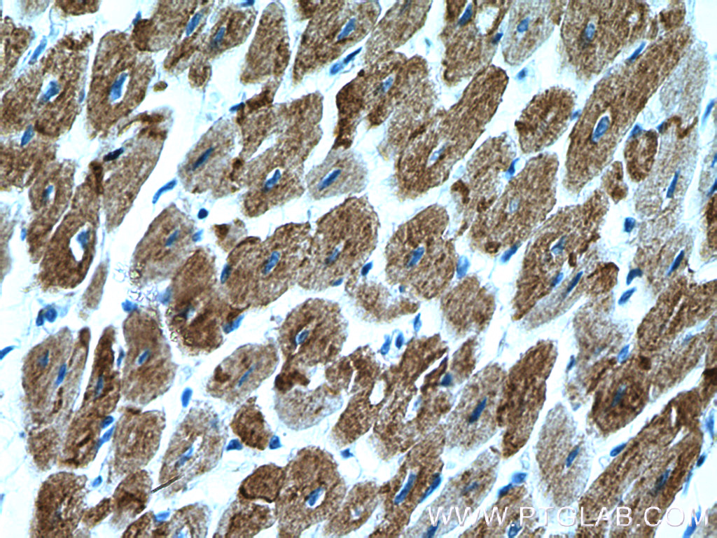 Desmin Antibody 16520-1-AP | Proteintech