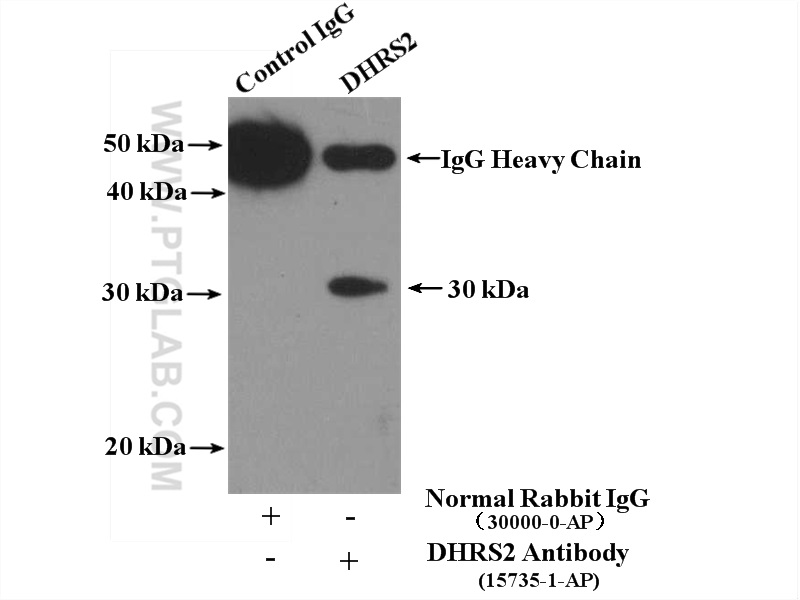 DHRS2 Antibody 15735-1-AP | Proteintech