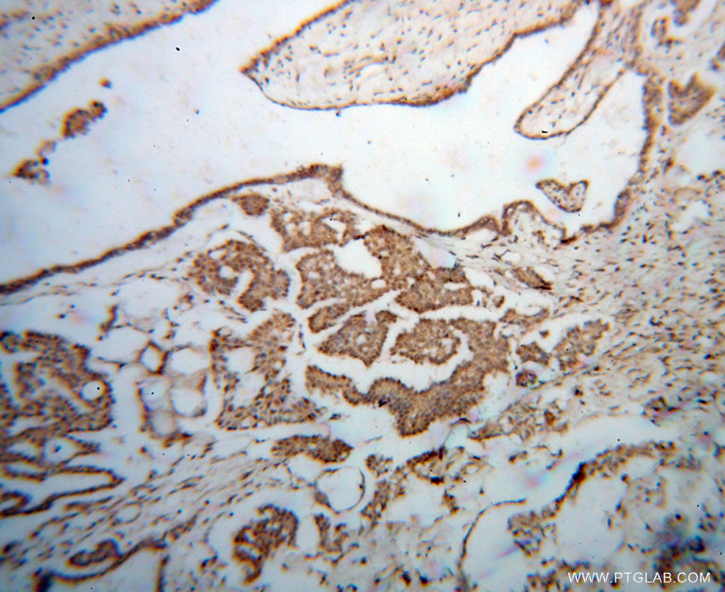 DIS3 Antibody 14689-1-AP | Proteintech