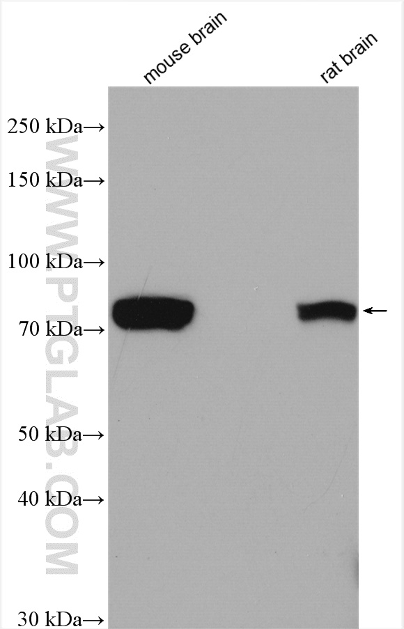 DRP1 (C-terminal) Antibody 12957-1-AP | Proteintech