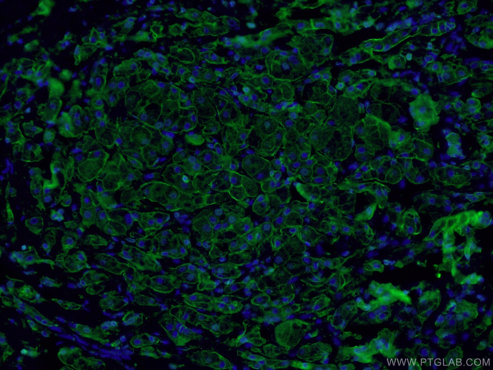 E-cadherin Antibody 20874-1-AP | Proteintech