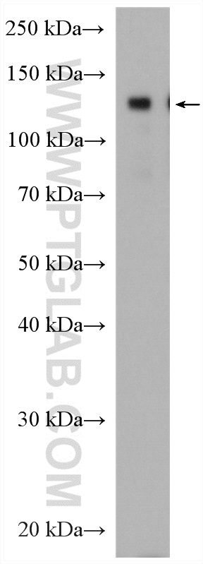 E-cadherin Antibody 20874-1-AP | Proteintech