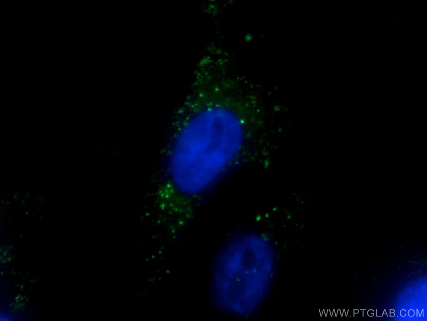 EEA1 Antibody 66218-1-Ig | Proteintech