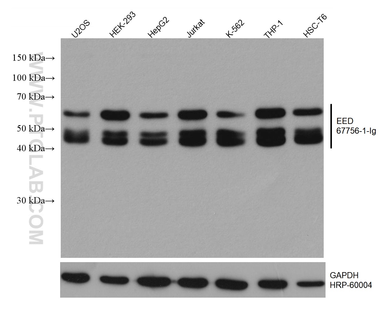 EED antibody (67756-1-Ig) | Proteintech | 武汉三鹰生物技术有限公司