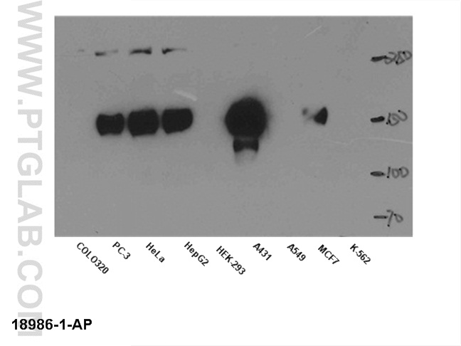 EGFR-Specific Antibody 18986-1-AP | Proteintech
