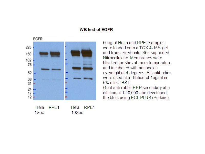 EGFR-Specific Antibody 18986-1-AP | Proteintech