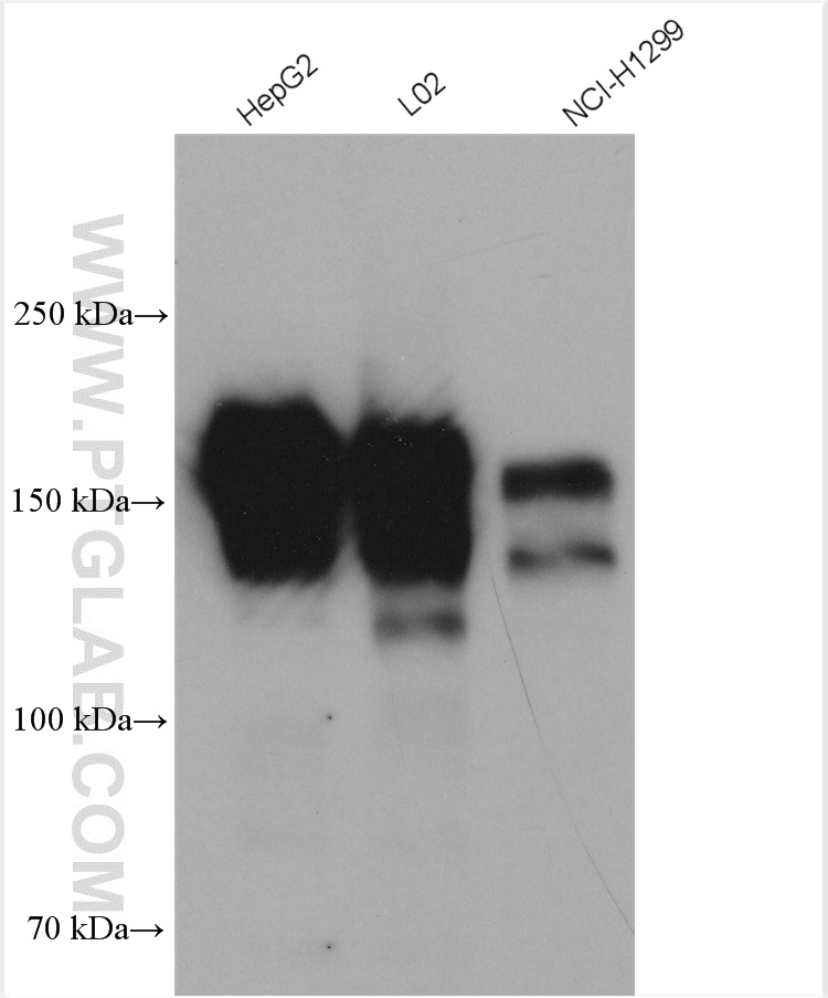 EGFR-Specific Antibody 18986-1-AP | Proteintech