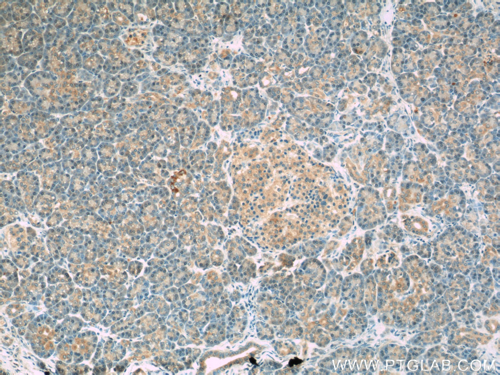 PERK/EIF2AK3 Antibody 24390-1-AP | Proteintech