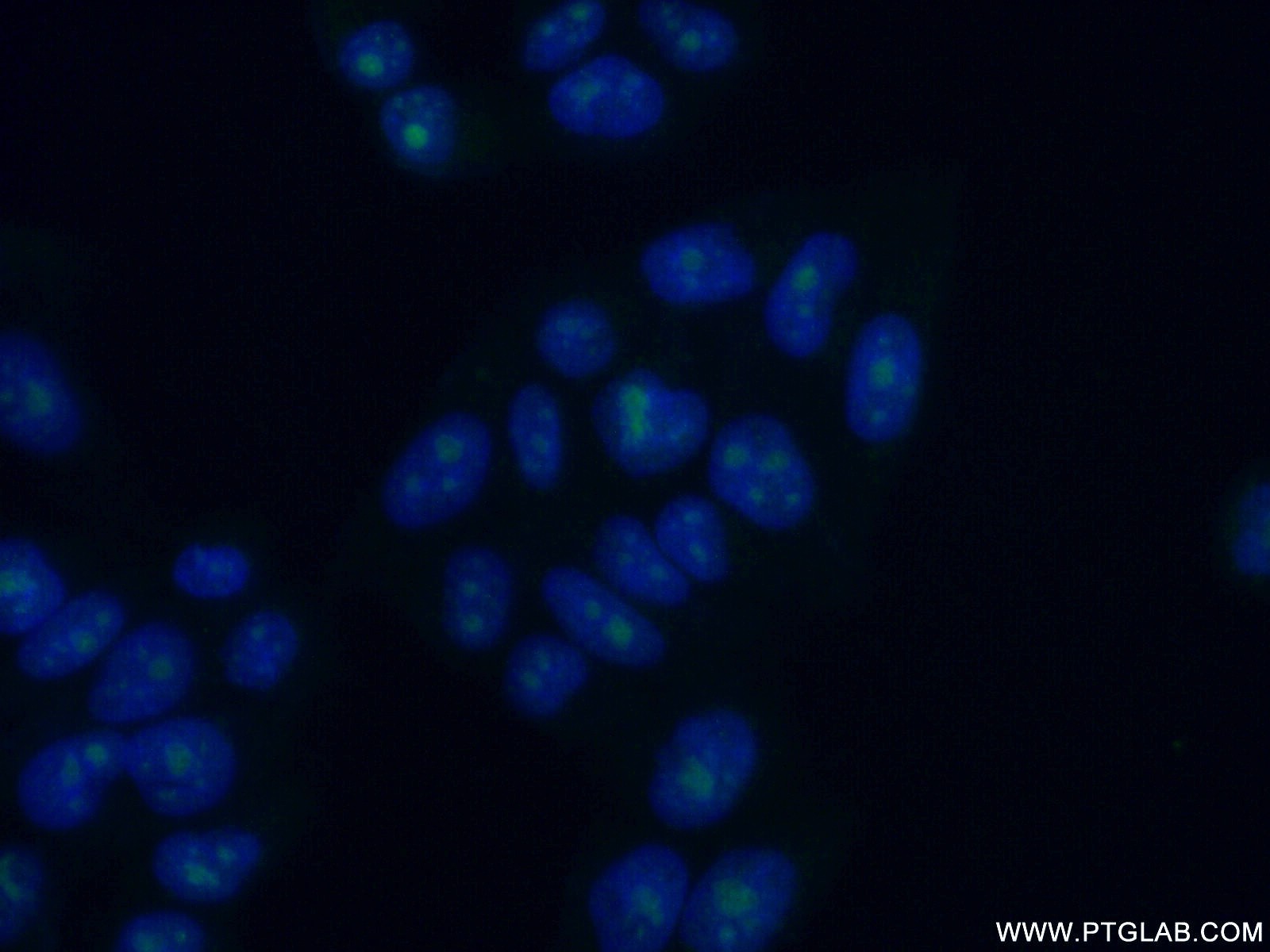 EIF6 Antibody 10291-1-AP | Proteintech