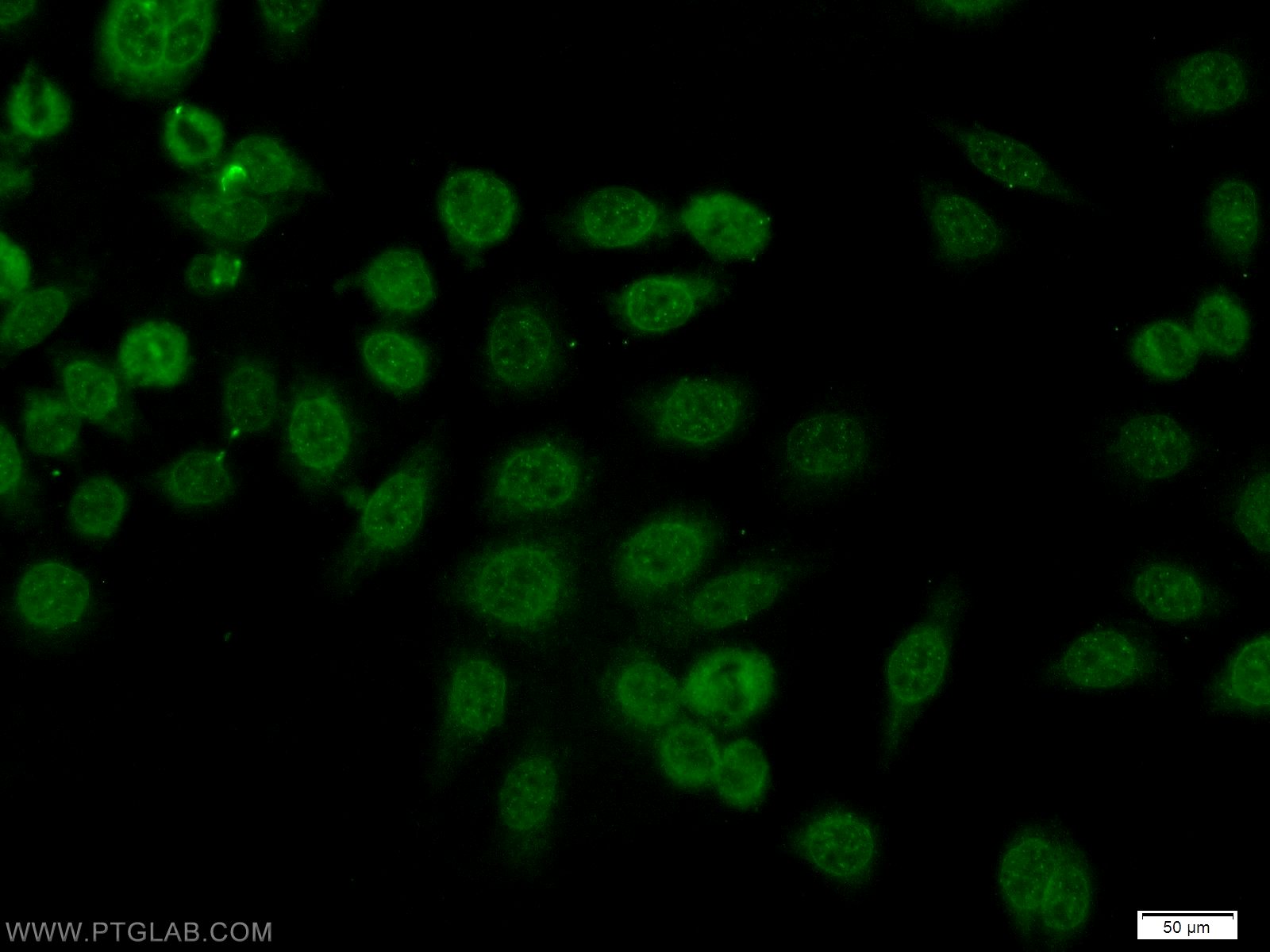 Emerin Antibody 10351-1-AP | Proteintech
