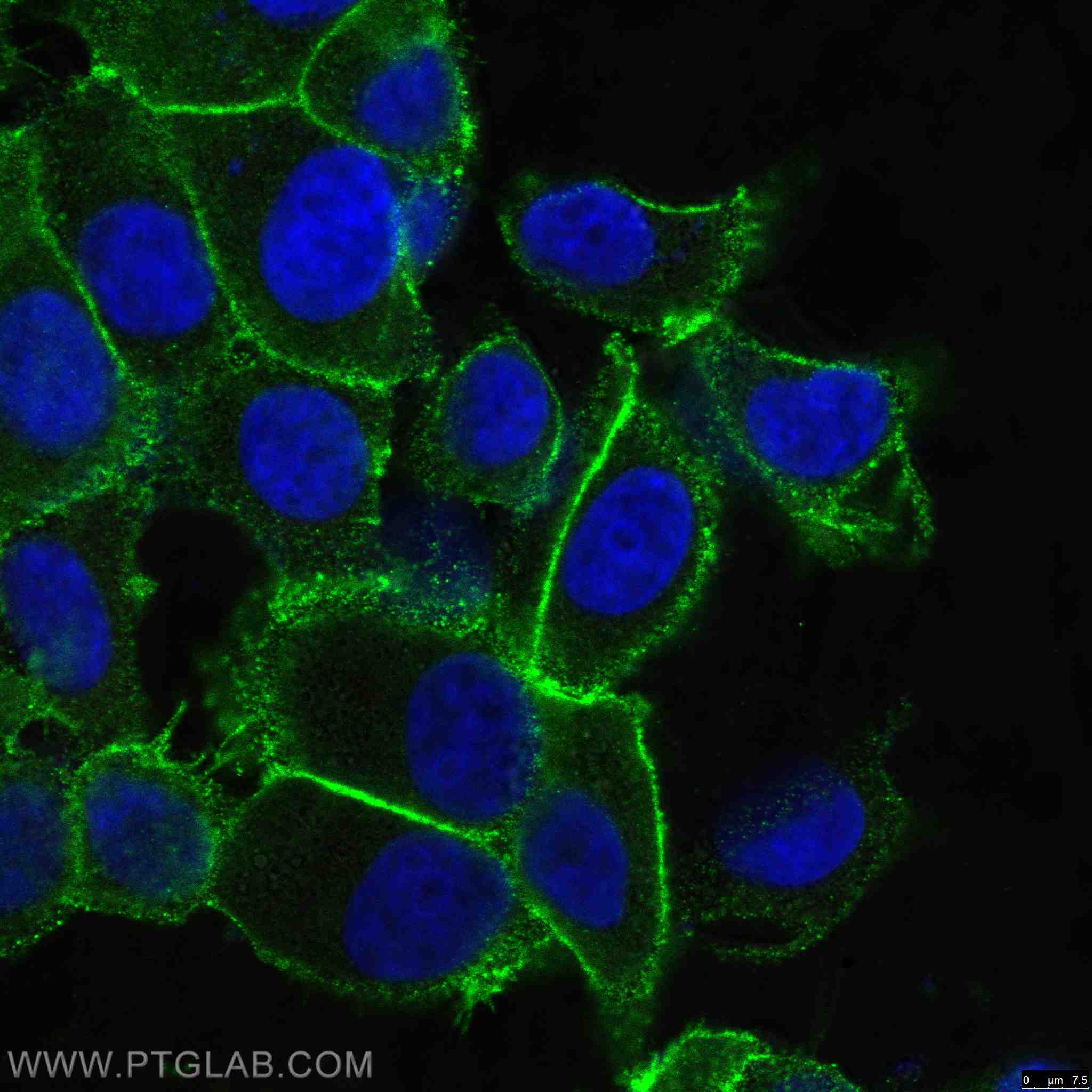 EPCAM Antibody 21050-1-AP | Proteintech