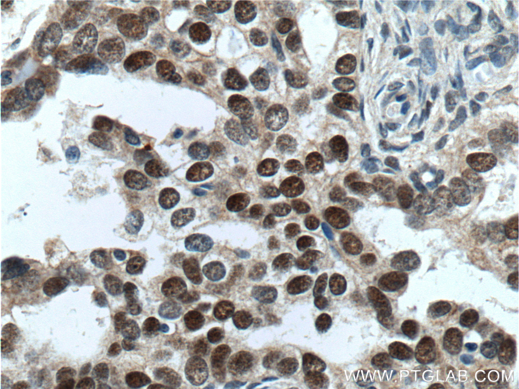 ER Antibody 21244-1-AP | Proteintech