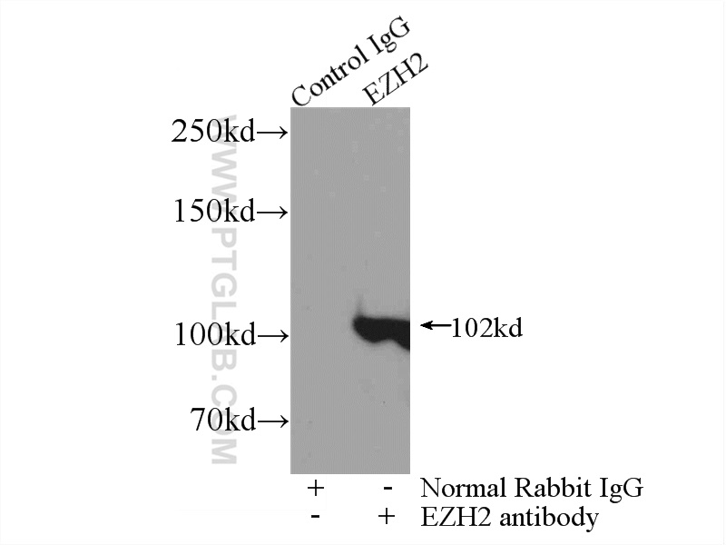 EZH2 Antibody 21800-1-AP | Proteintech