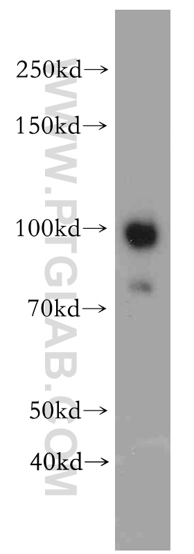 EZH2 Antibody 21800-1-AP | Proteintech