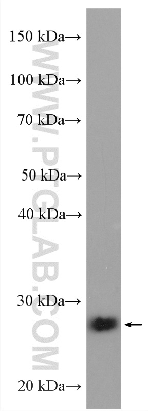 FADD Antibody 14906-1-AP | Proteintech