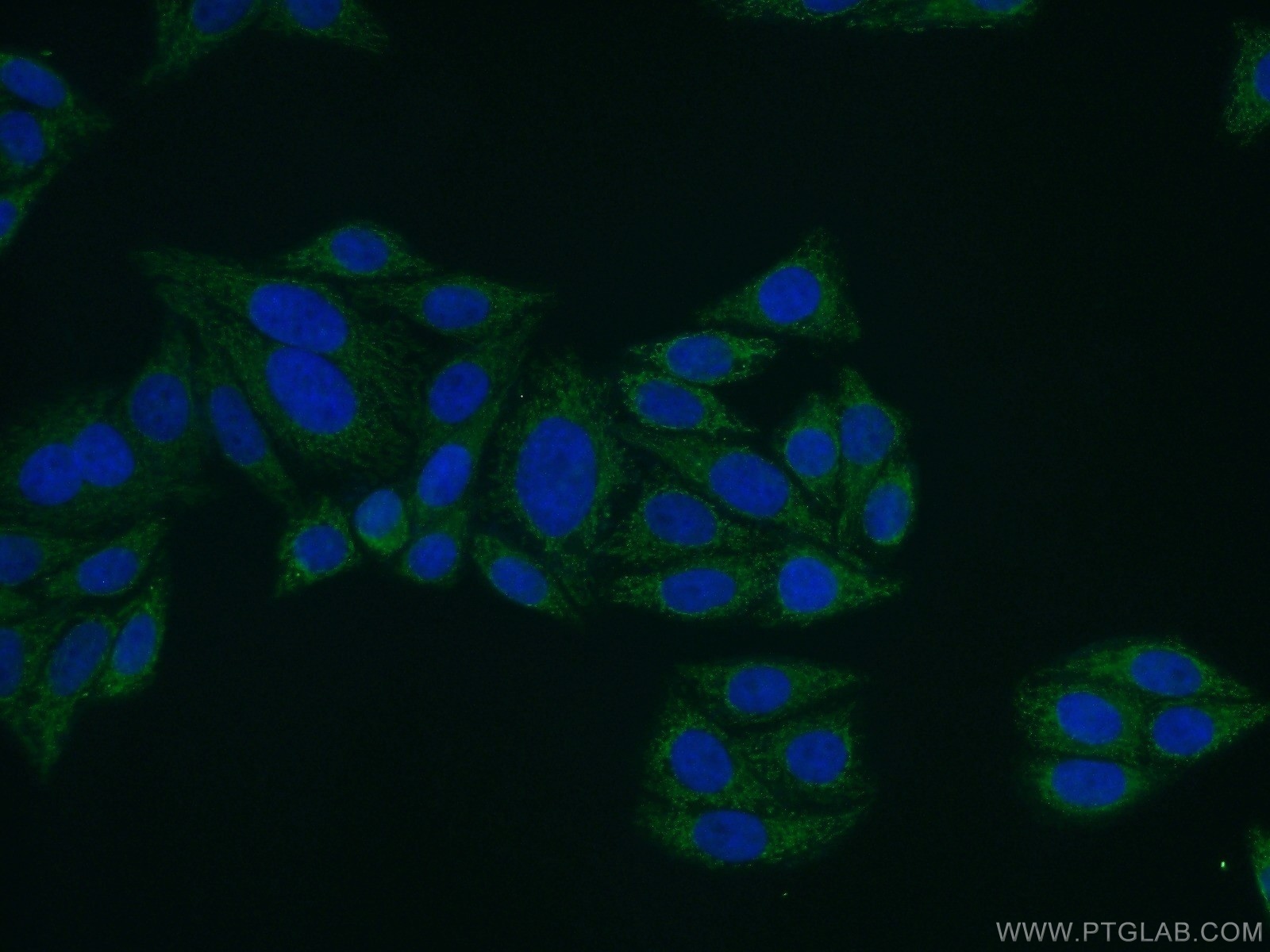 FOXA2 Antibody 22474-1-AP | Proteintech