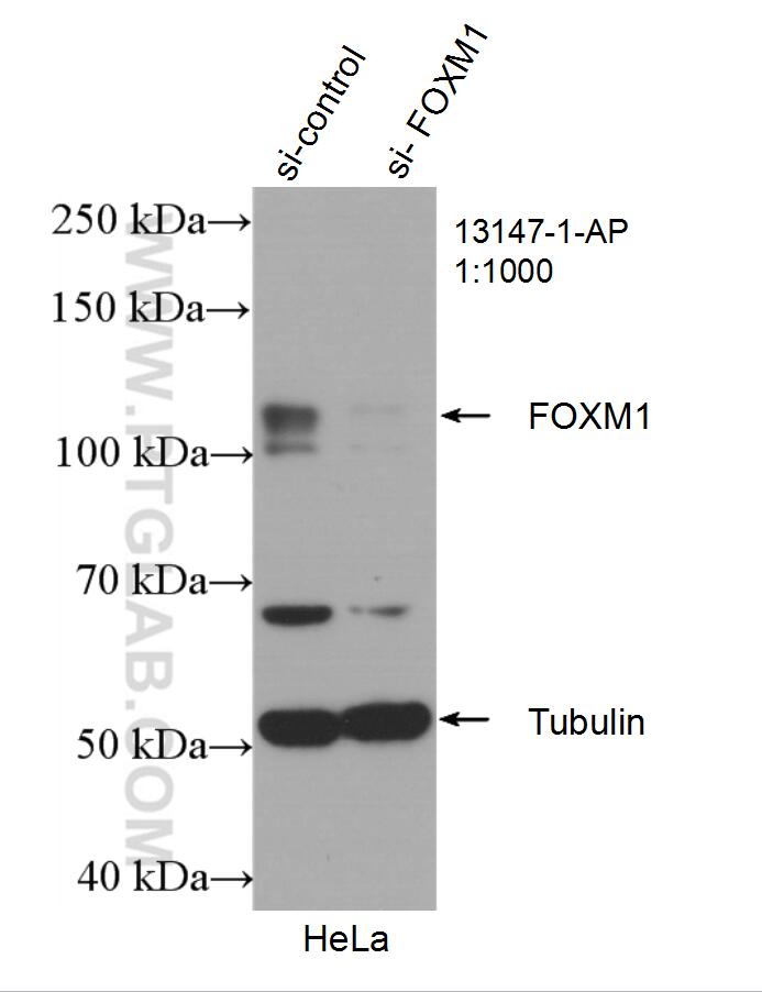 FOXM1 Antibody 13147-1-AP | Proteintech