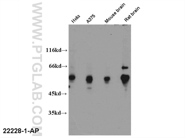 FOXP3 Antibody 22228-1-AP | Proteintech