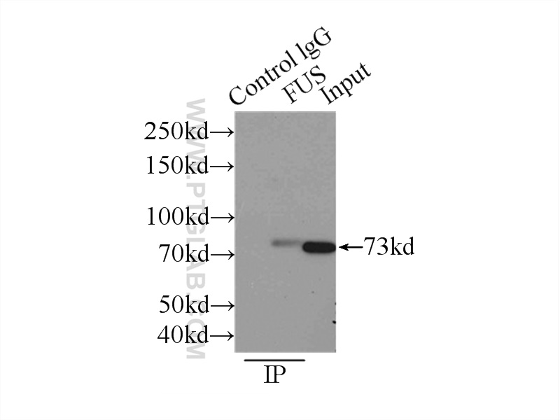 FUS/TLS Antibody 11570-1-AP | Proteintech