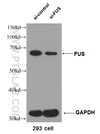 FUS/TLS Antibody 11570-1-AP | Proteintech