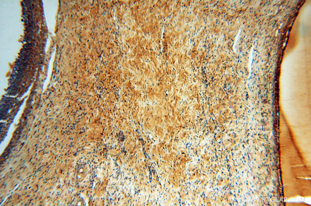 GAS6 Antibody 13795-1-AP | Proteintech