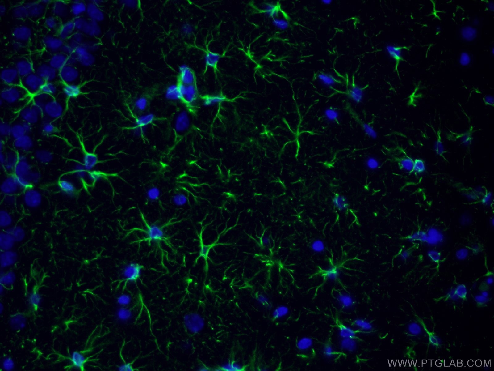 GFAP Antibody 16825-1-AP | Proteintech