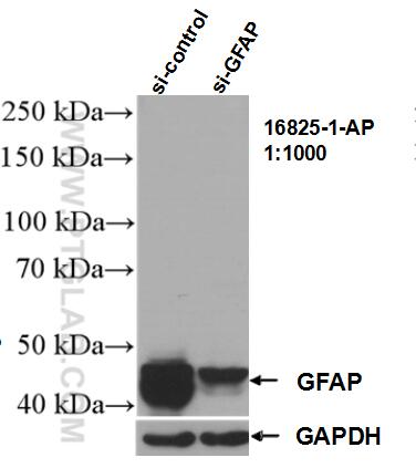 GFAP Antibody 16825-1-AP | Proteintech
