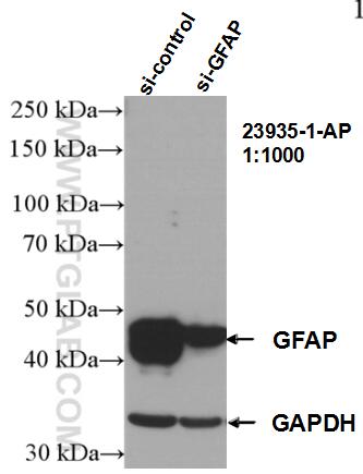 GFAP Antibody 23935-1-AP | Proteintech