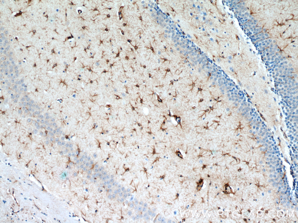 GFAP Antibody 60190-1-Ig | Proteintech