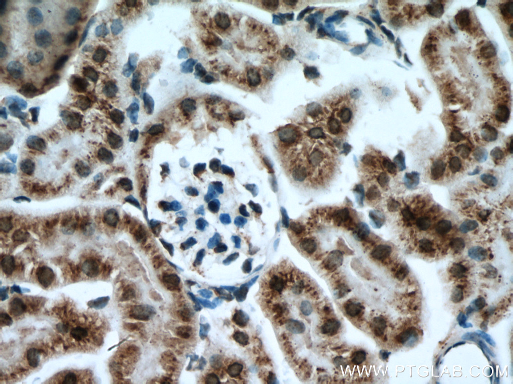 GOLGA2/GM130 Antibody 11308-1-AP | Proteintech