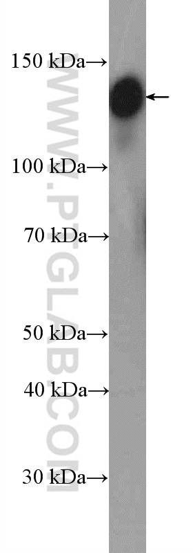 GOLGA2/GM130 Antibody 11308-1-AP | Proteintech