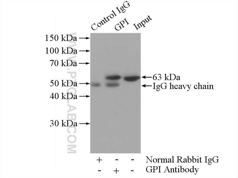 GPI Antibody 15171-1-AP | Proteintech