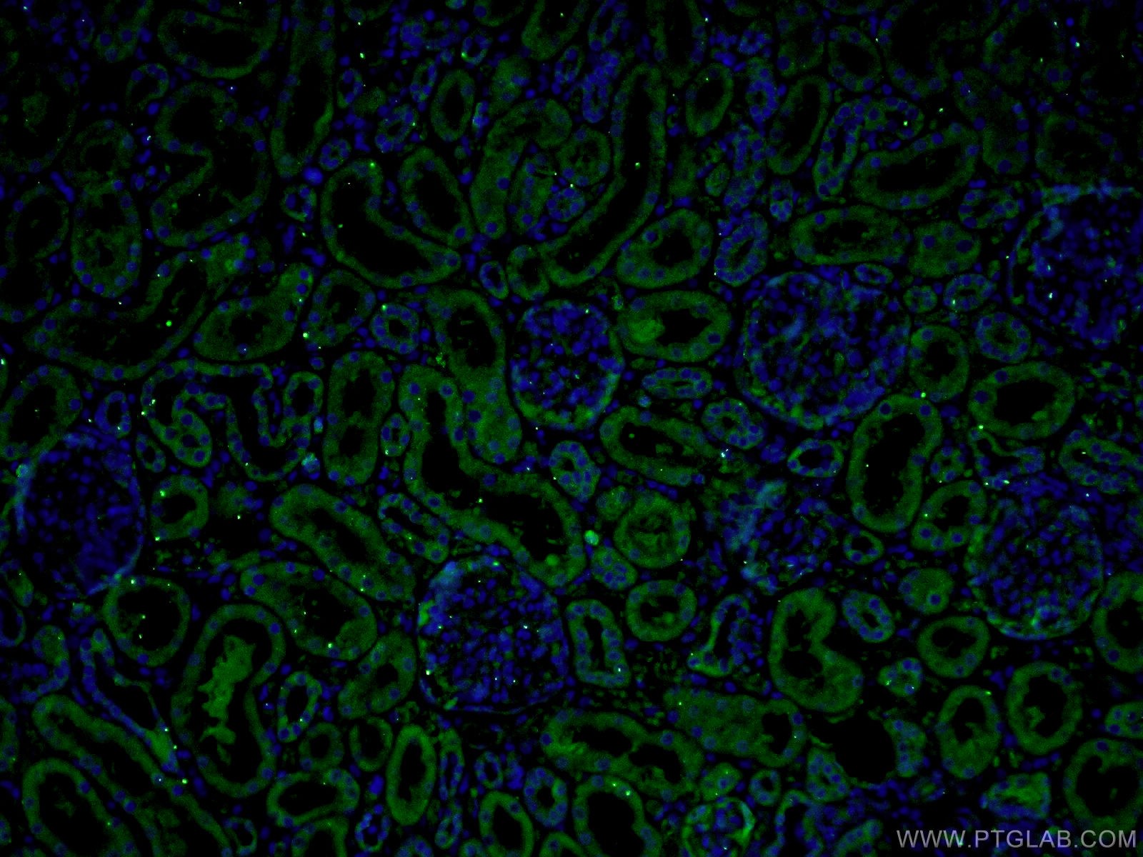 GPX4 Antibody 14432-1-AP | Proteintech