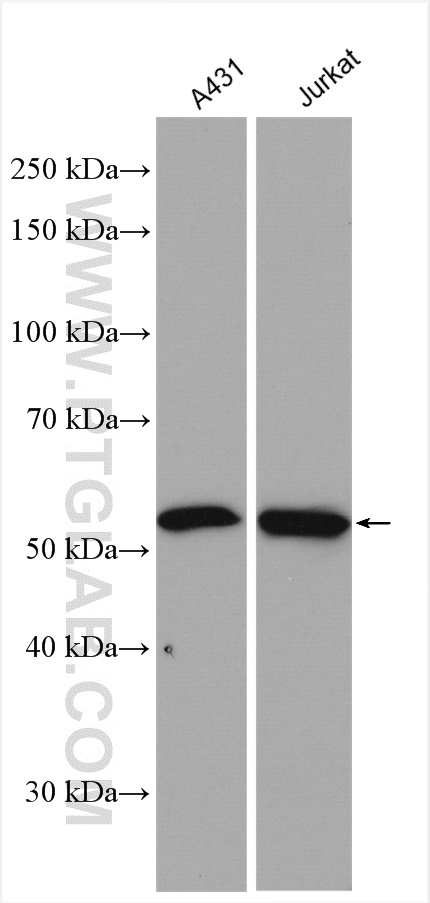 GSDMD Antibody 20770-1-AP | Proteintech