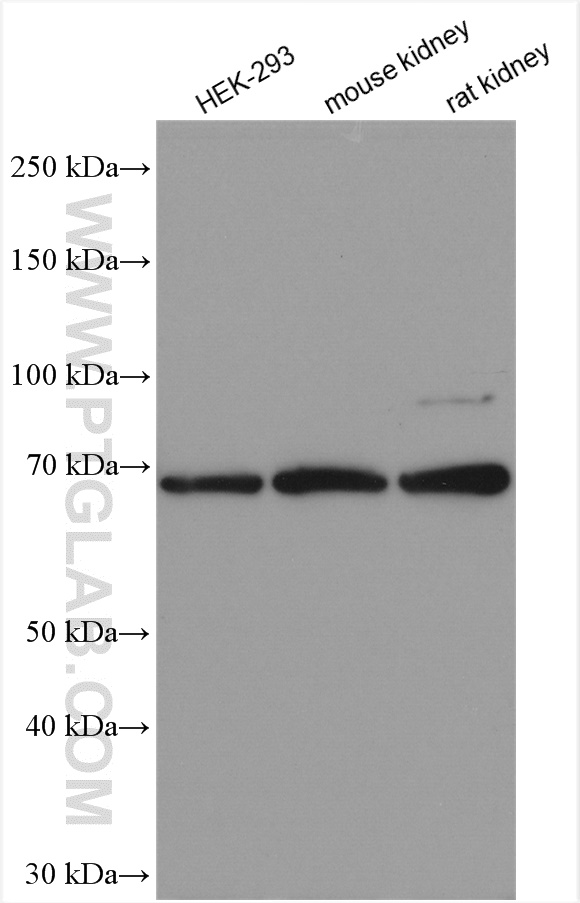 HEXB Antibody 16229-1-AP | Proteintech