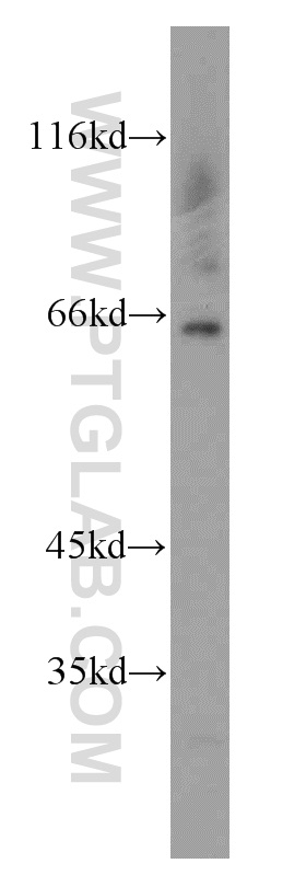 HEXB Antibody 16229-1-AP | Proteintech