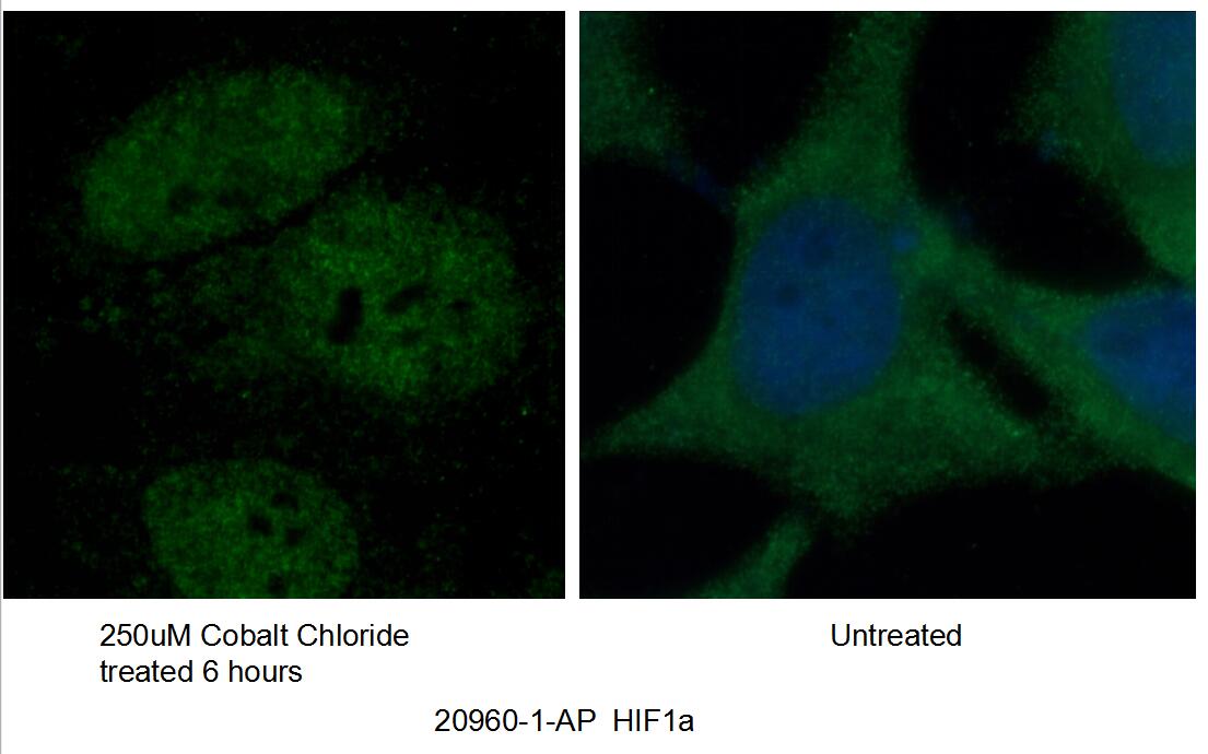 HIF1a Antibody 20960-1-AP | Proteintech