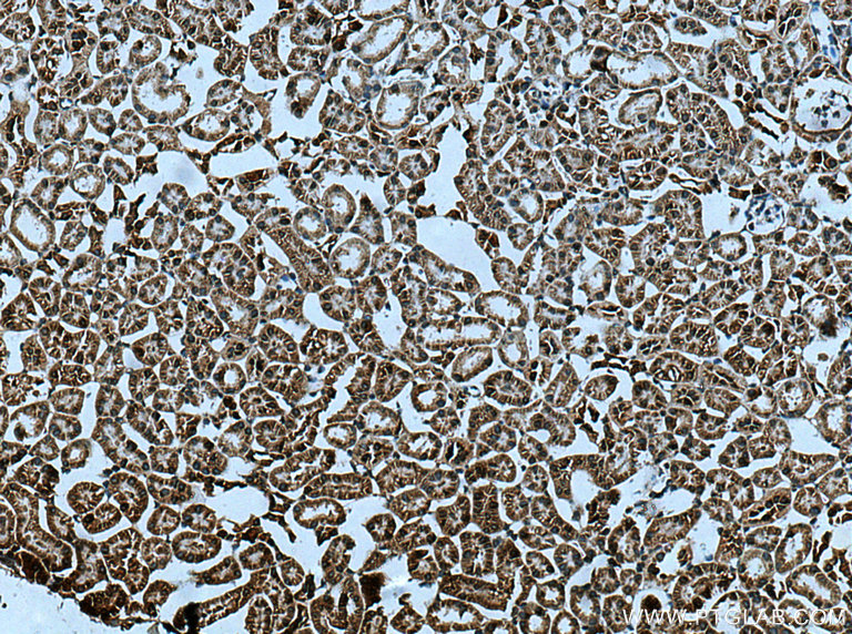 HIF1a Antibody 20960-1-AP | Proteintech