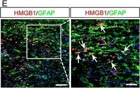HMGB1 Antibody 10829-1-AP | Proteintech