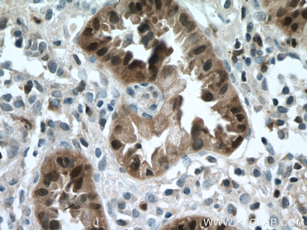 HOPX Antibody 11419-1-AP | Proteintech