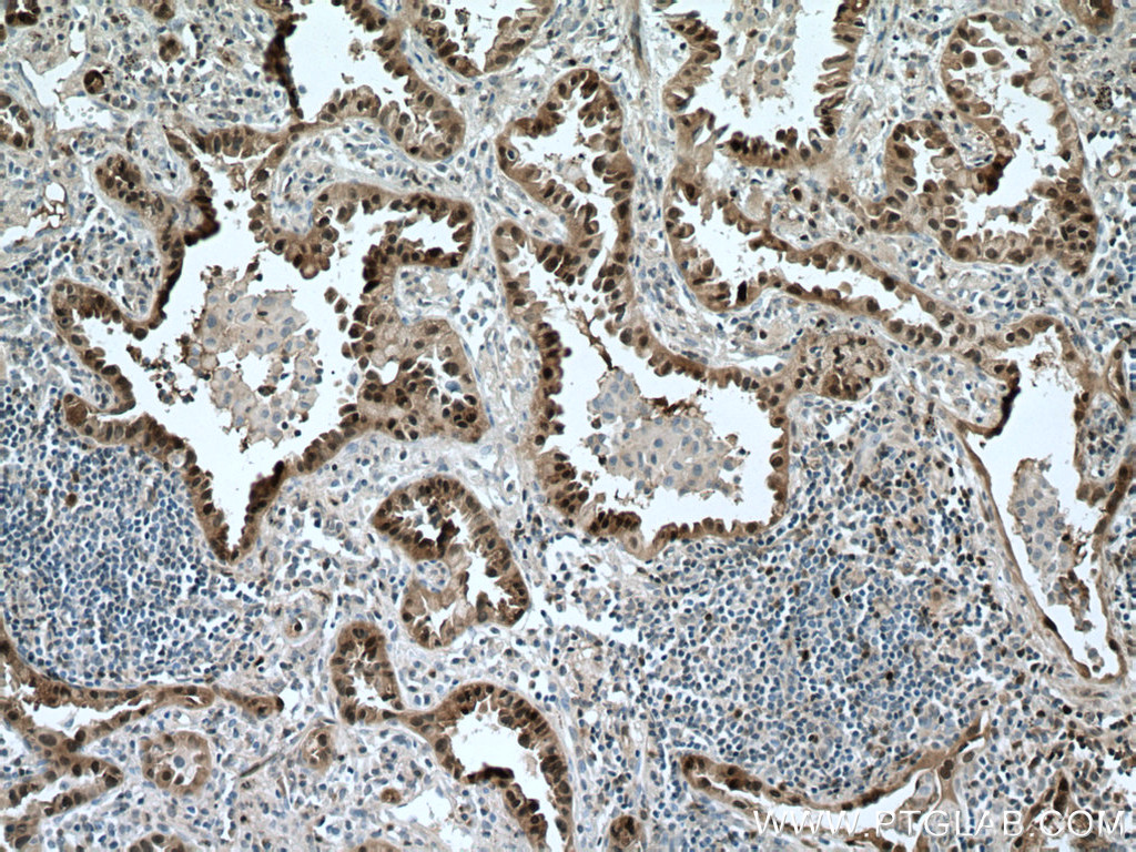 HOPX Antibody 11419-1-AP | Proteintech