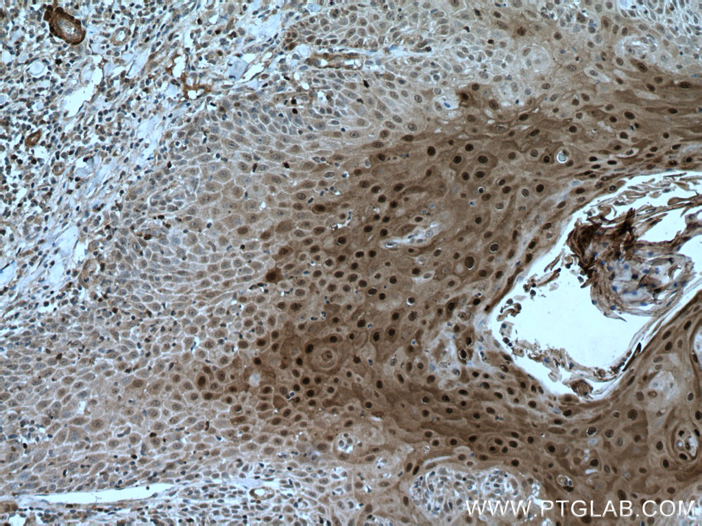 HOPX Antibody 11419-1-AP | Proteintech