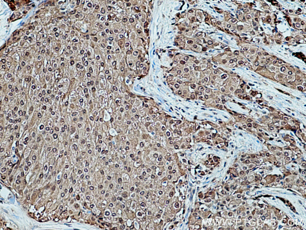 HSP70 Antibody 10995-1-AP | Proteintech