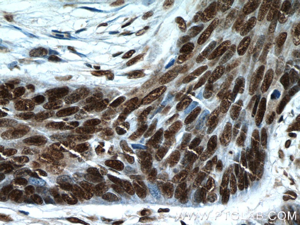 Histone H3 Antibody 17168 1 Ap Proteintech
