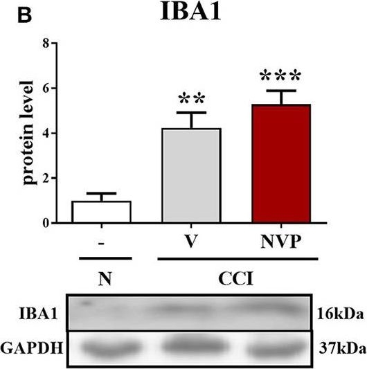 IBA1 Antibody 10904-1-AP | Proteintech
