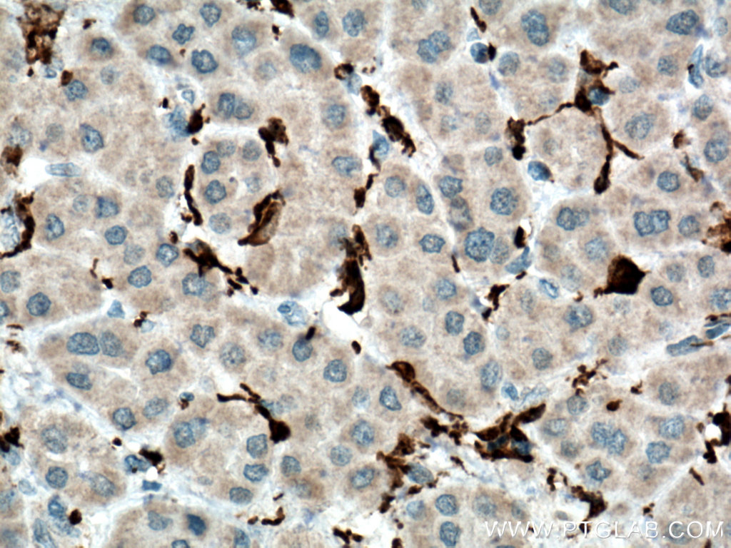 IBA1 Antibody 66827-1-Ig | Proteintech