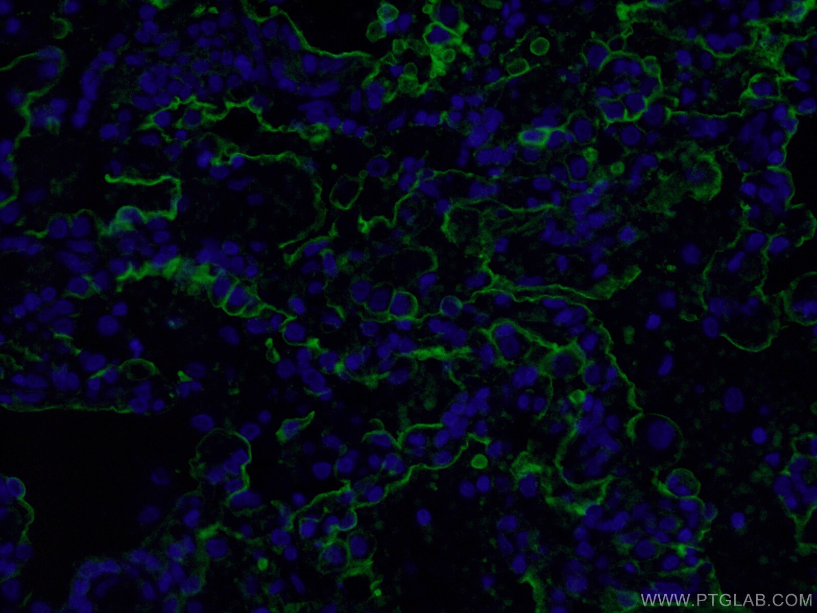 ICAM-1 Antibody 10831-1-AP | Proteintech