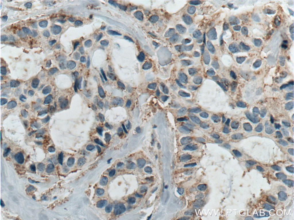 ICAM2 Antibody 10121-2-AP | Proteintech