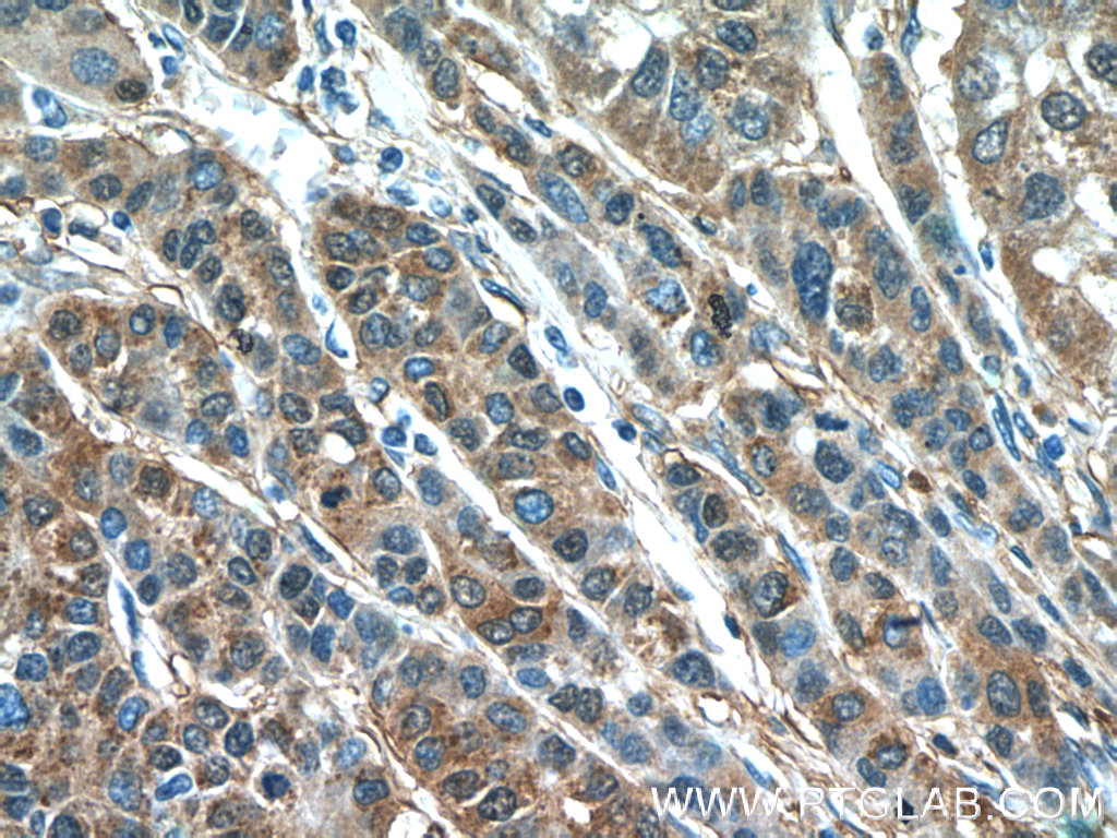 IDH1 Antibody 12332-1-AP | Proteintech
