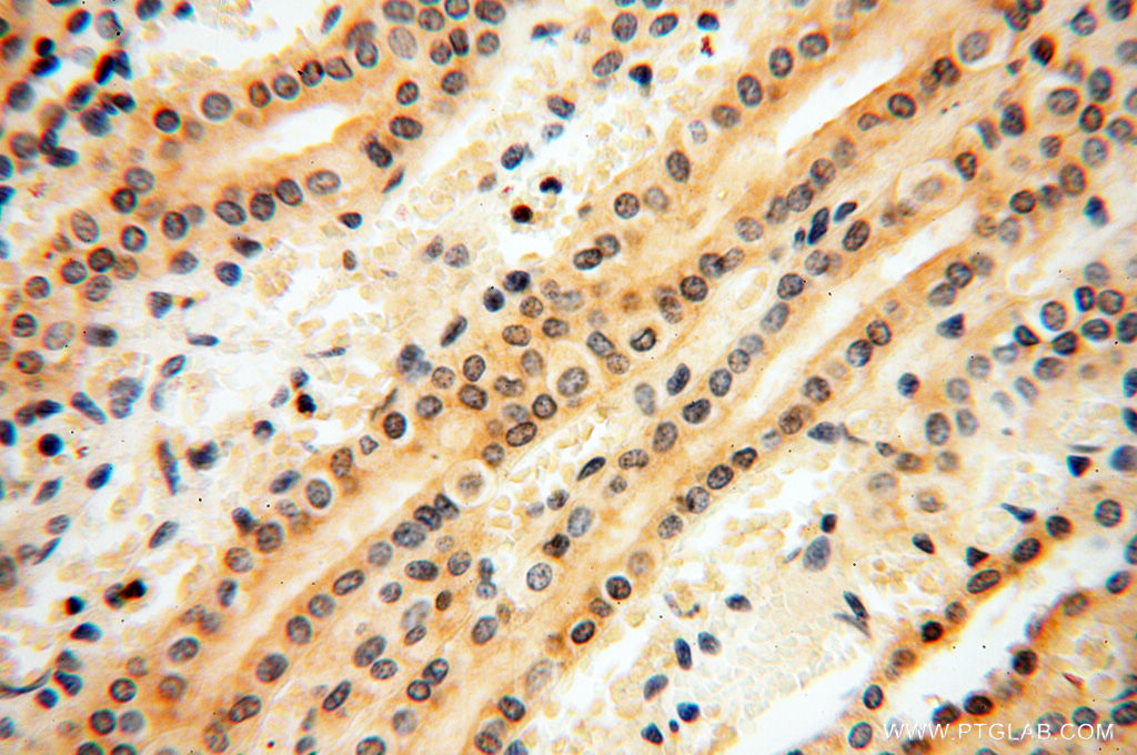 IDH1 Antibody 12332-1-AP | Proteintech